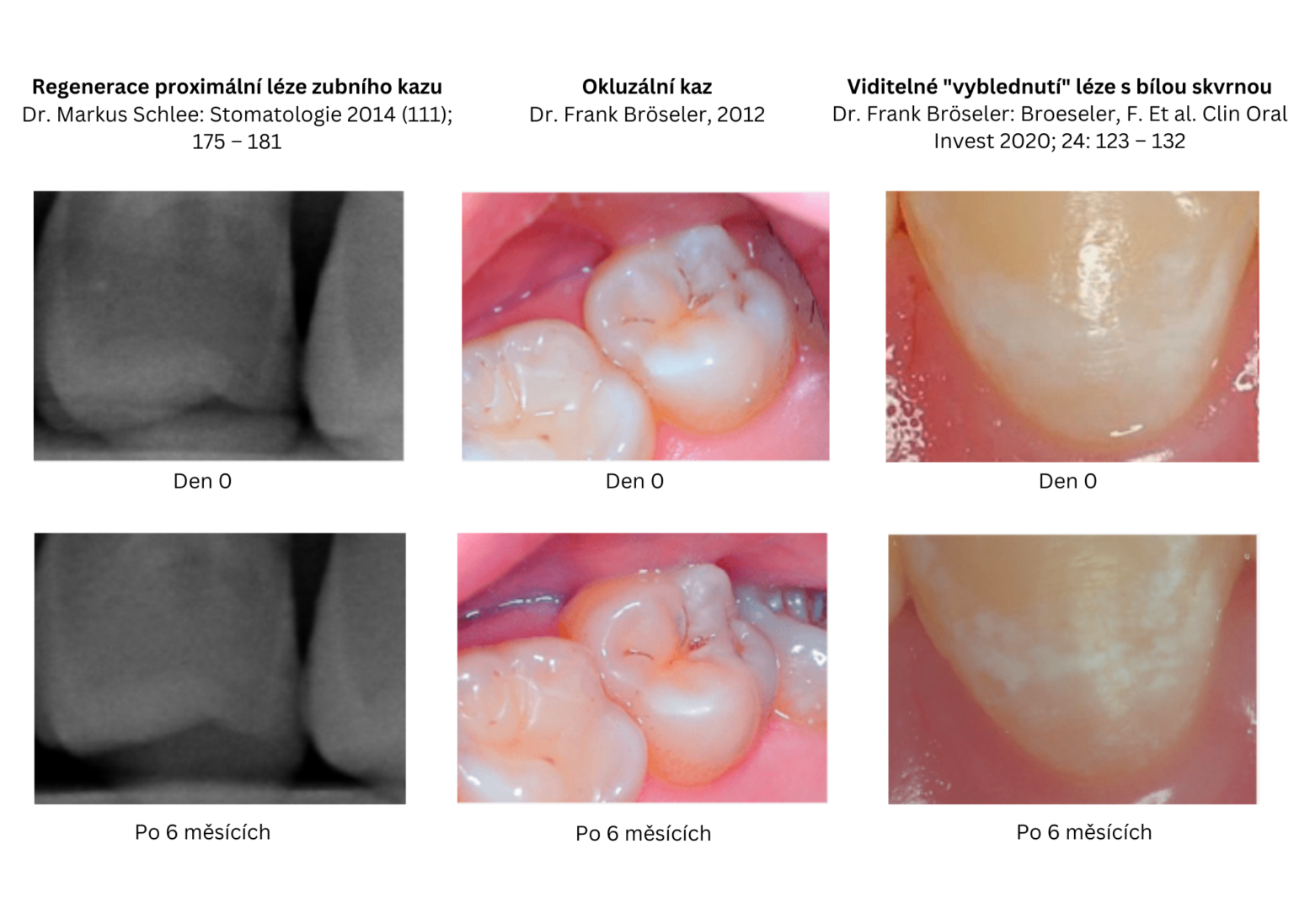 CURODONT™ REPAIR - kazybezvrtani.cz